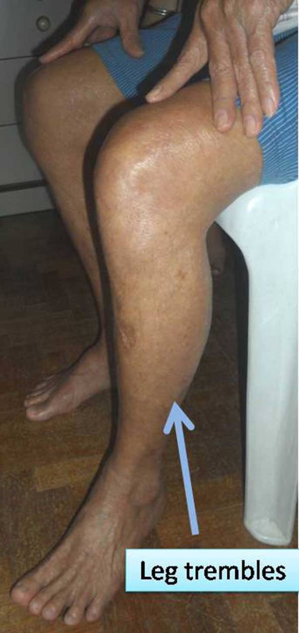 Part 3: Side effects of medical treatment and attitude of doctors ...